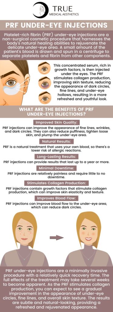 PRF Under Eye Injections Specialist Near Me in Avon, CT